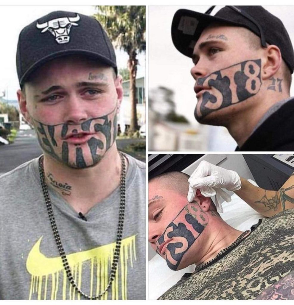 From “Devast8” to a Fresh Start: How a Face Tattoo Changed One Man’s ...